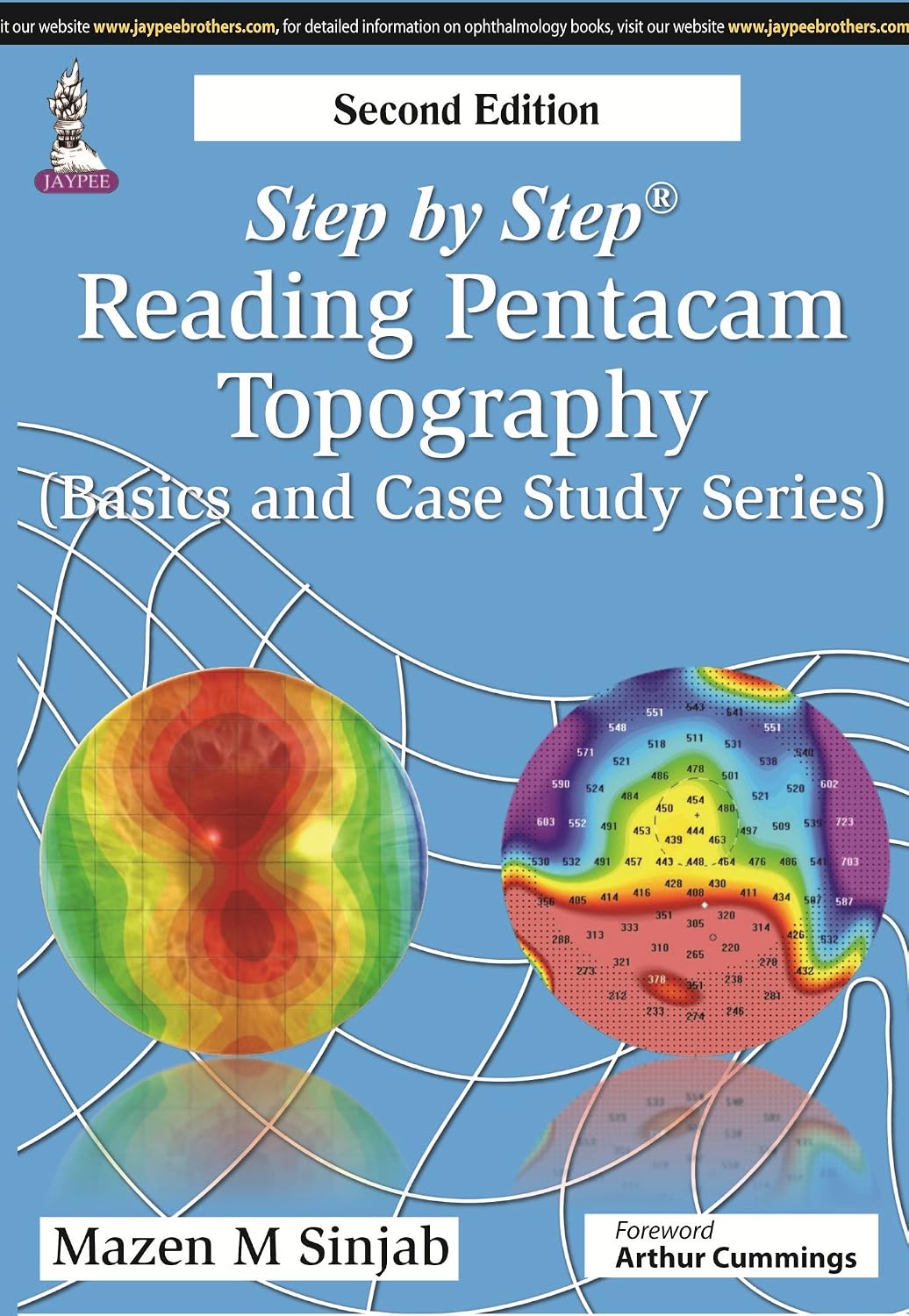 Step by Step: Reading Pentacam Topography: (Basic and Case Study Series ...