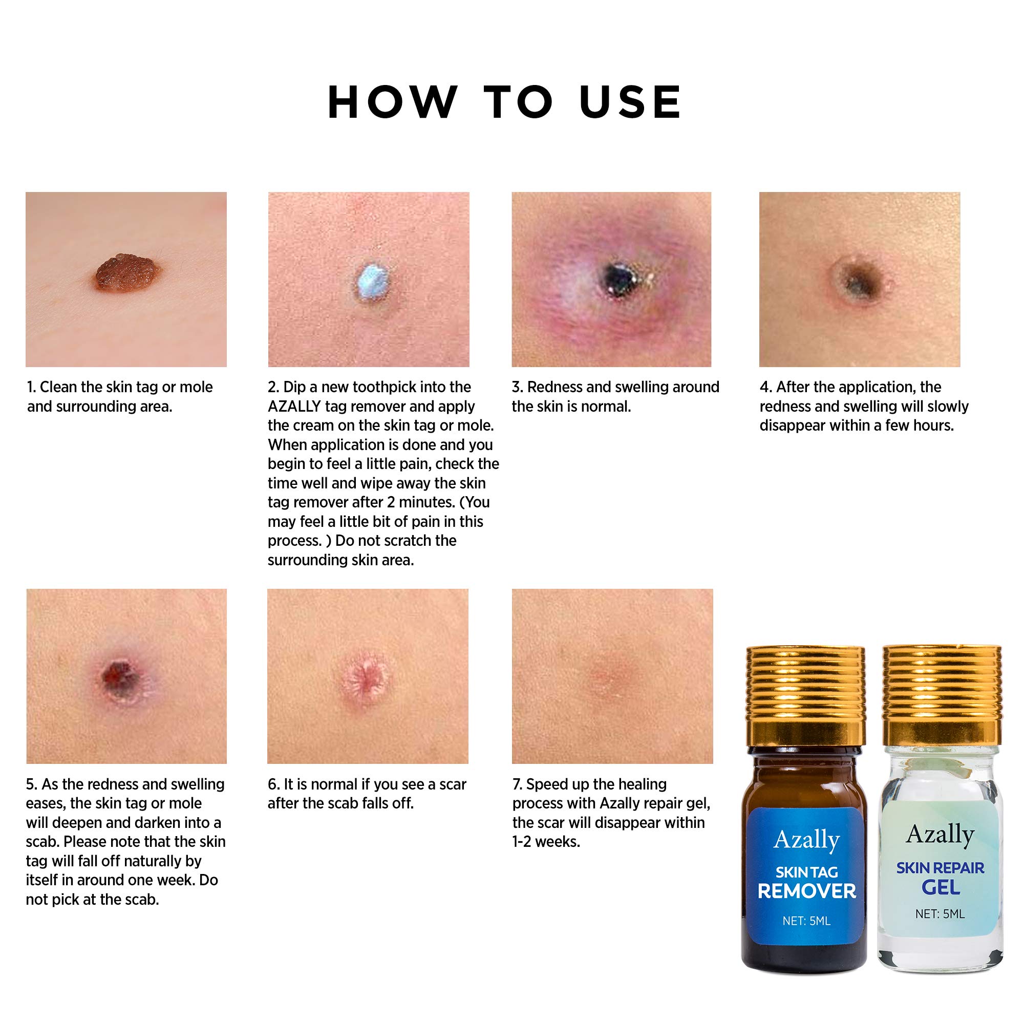 Azally Mole Corrector & Skin Tag Remover Cream with Repair Gel, Remove ...