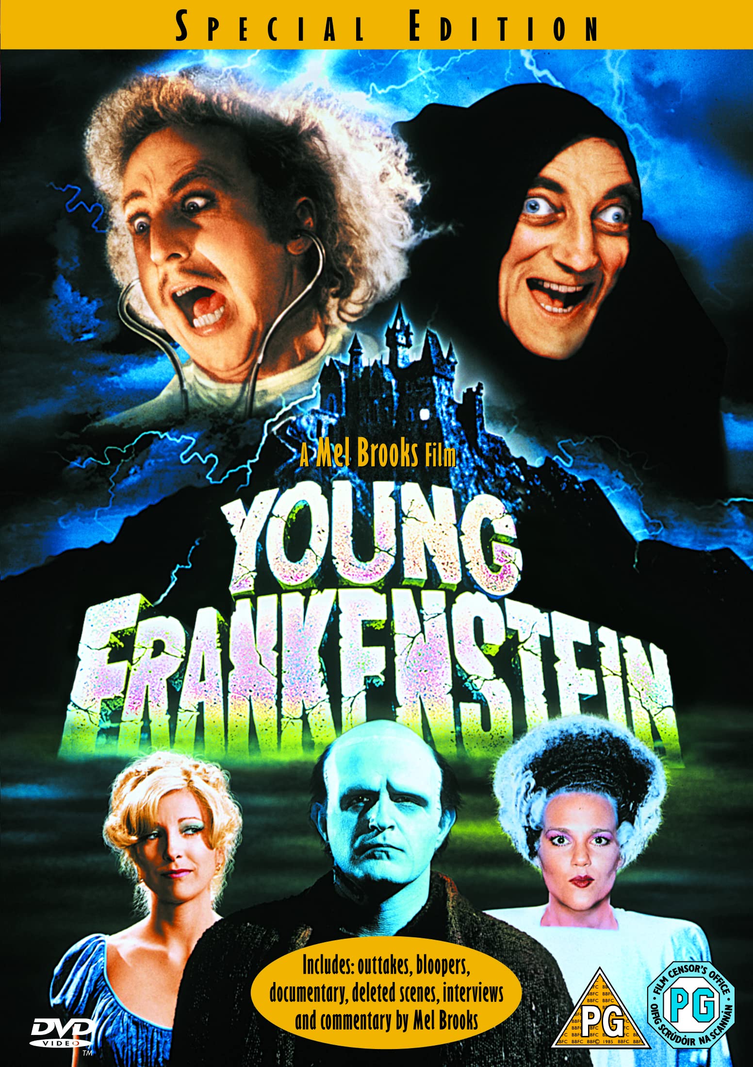 Marty Feldman Young Frankenstein