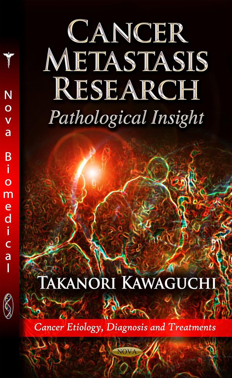 Cancer Metastasis Research: Pathological Insight (Cancer Etiology ...