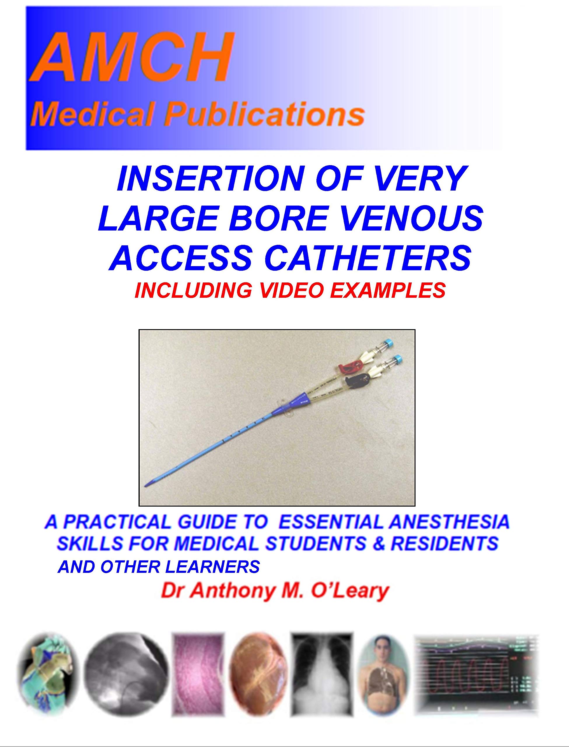Insertion Of Large Bore Venous Access A Practical Approach To ...