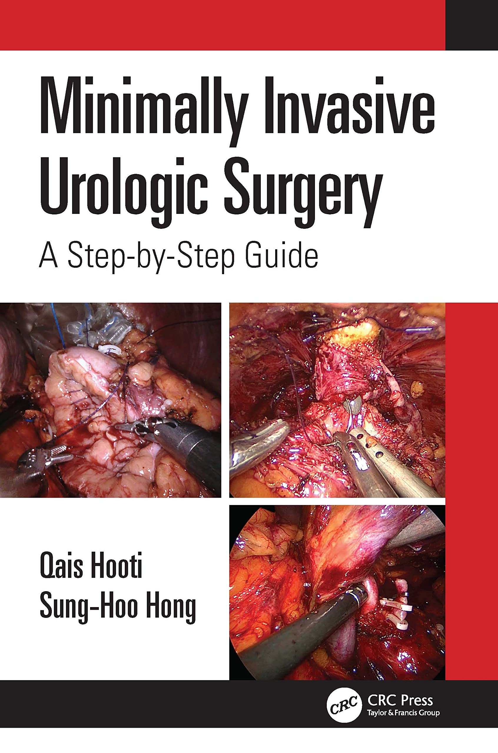 Minimally Invasive Urologic Surgery: A Step-by-Step Guide ...