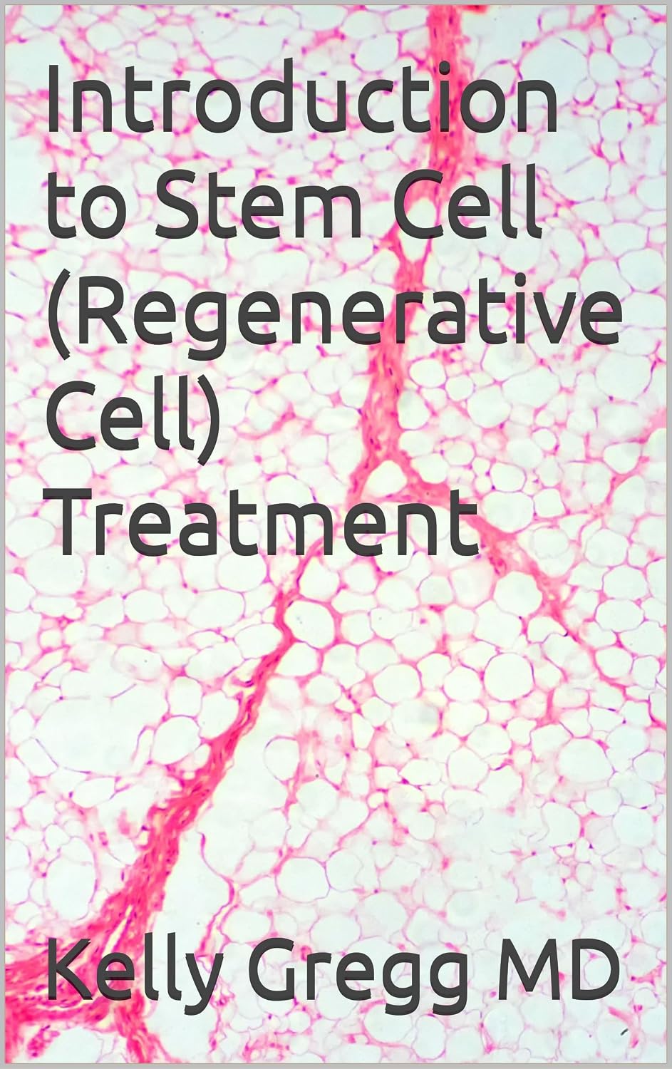 Introduction to Stem Cell (Regenerative Cell) Treatment - Kindle ...