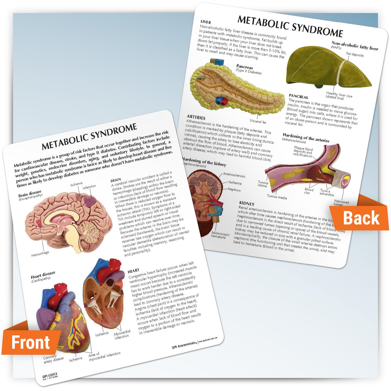 Snapklik.com : Metabolic Syndrome Model Set, Replica For Human Anatomy ...