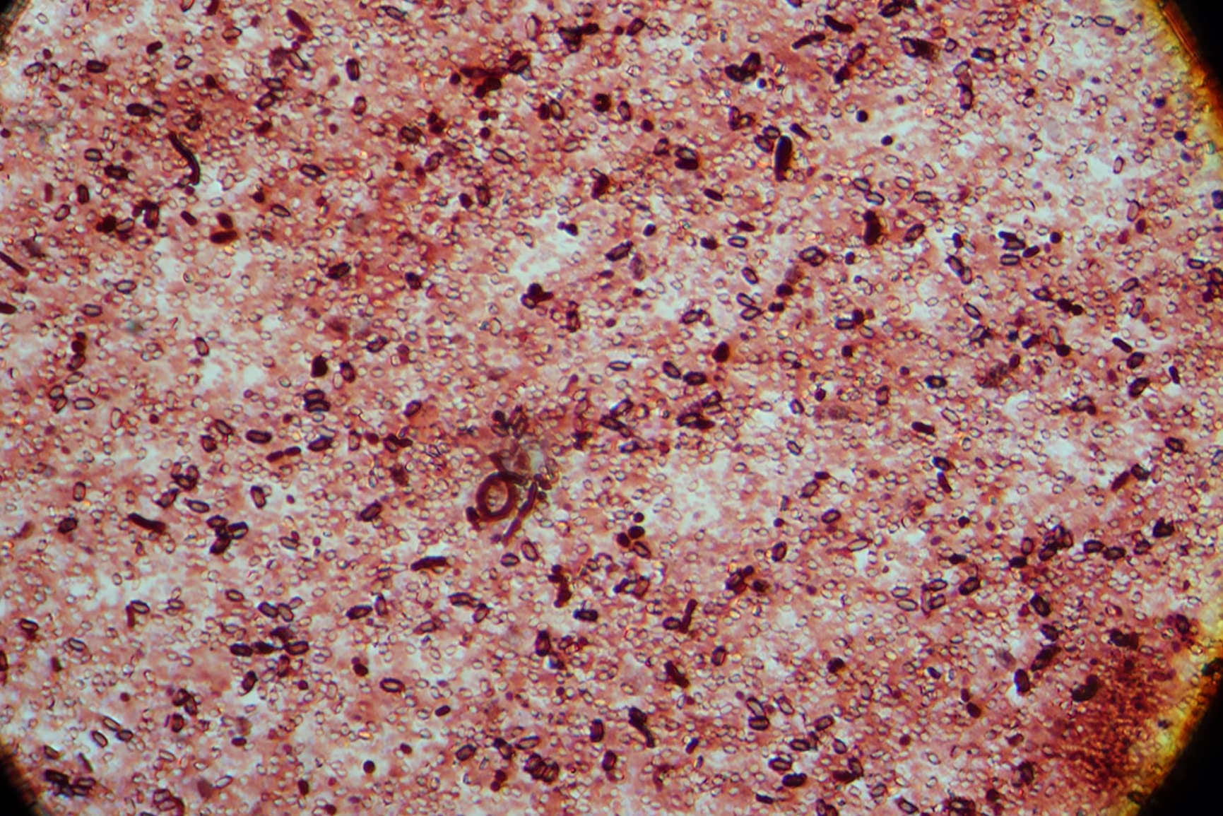 HAJXZH 1ul 100 Pcs Disposable Plastic Inoculation Loop Scientific ...