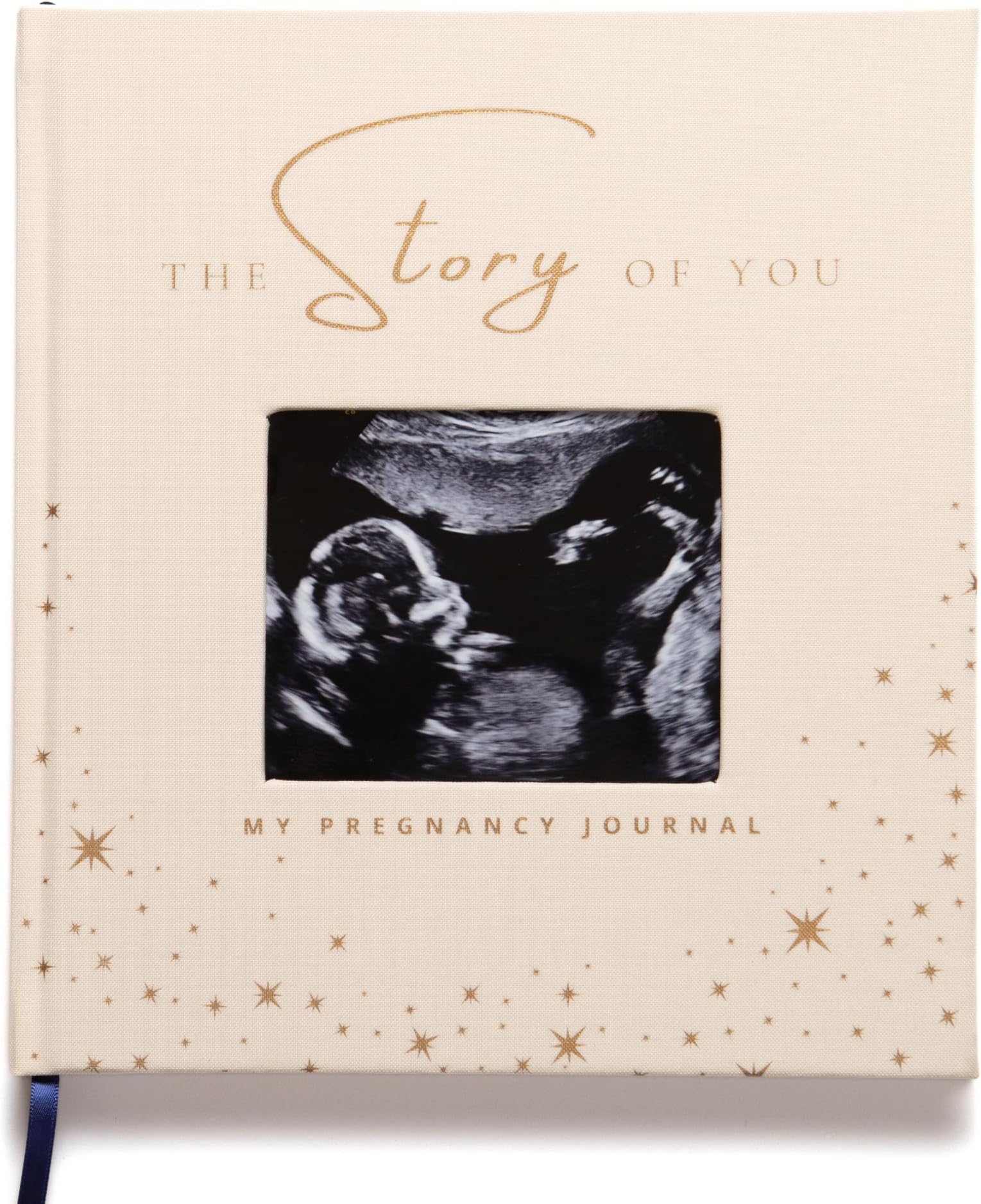 Amazon.com: Pregnancy Journal & Baby Memory Book - 150 Pages Baby Book ...