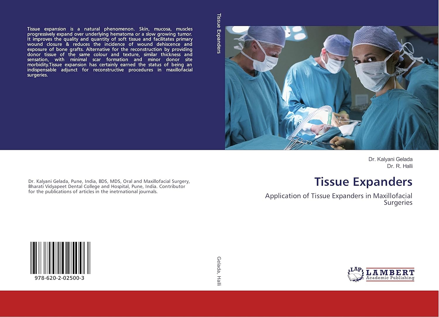 Tissue Expanders: Application of Tissue Expanders in Maxillofacial ...