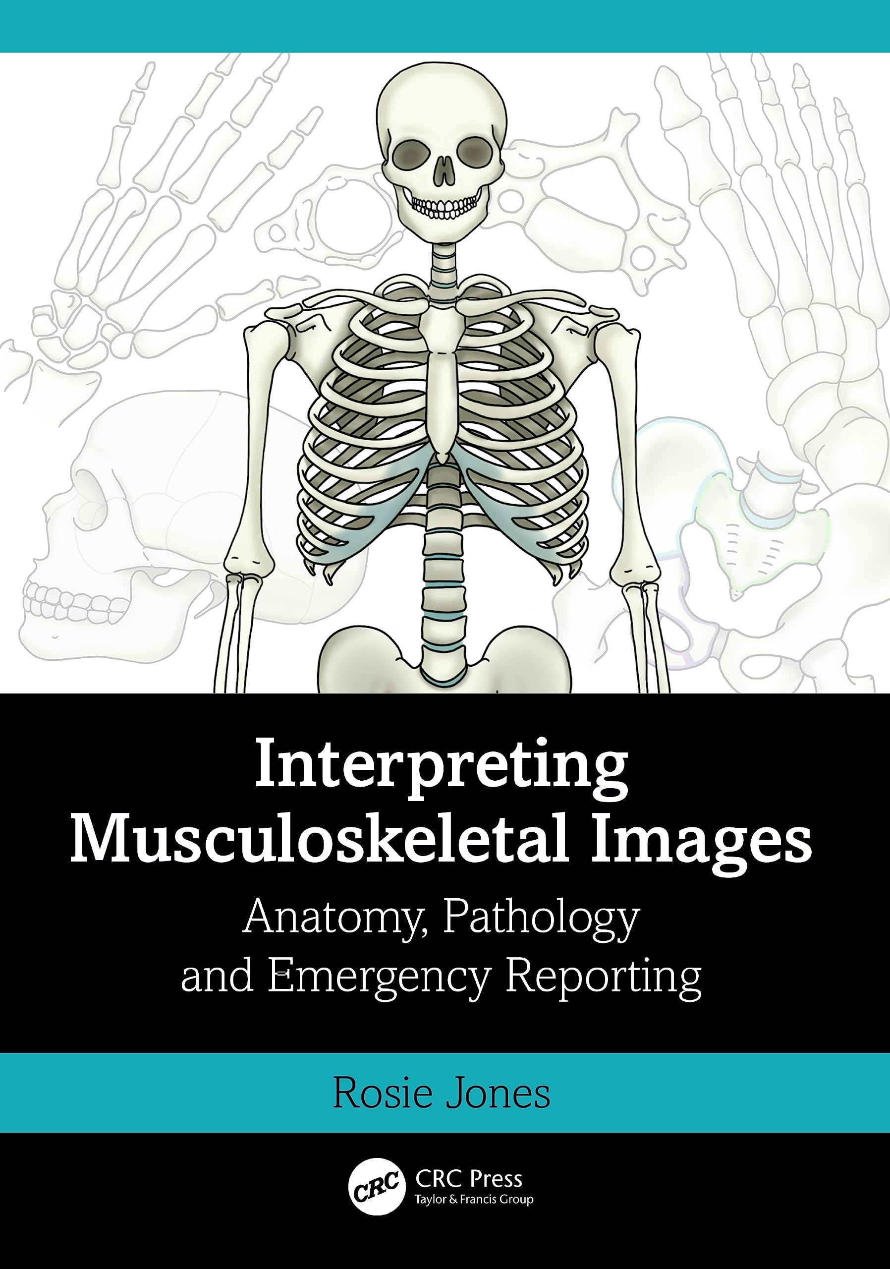 Interpreting Musculoskeletal Images: Anatomy, Pathology and Emergency ...