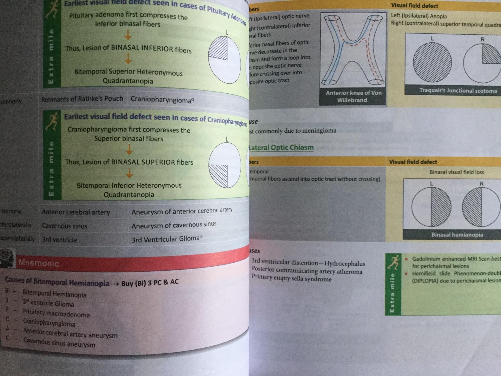 Buy SOCH SIMPLIFIED OPHTHALMOLOGY CONCEPTUAL HANDBOOK (PB 2017) BANSAL ...