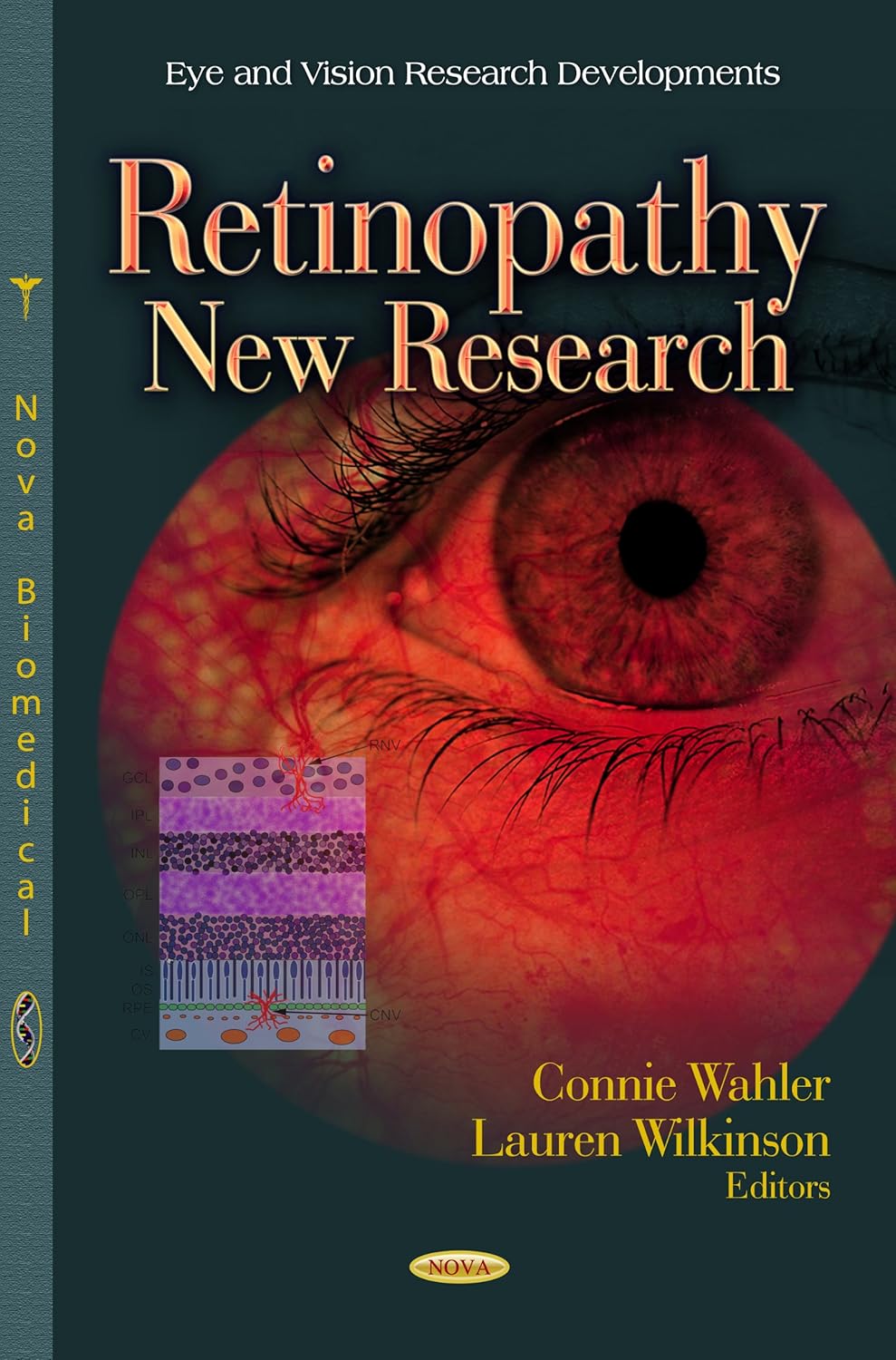 Retinopathy: New Research (Eye and Vision Research Developments ...