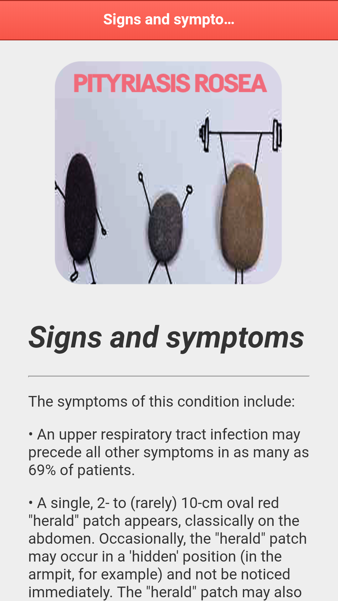 Pityriasis Rosea Disease - App on Amazon Appstore