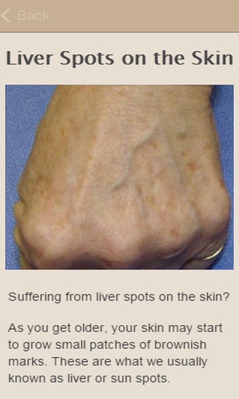How To Remove Liver Spots - App on the Amazon Appstore