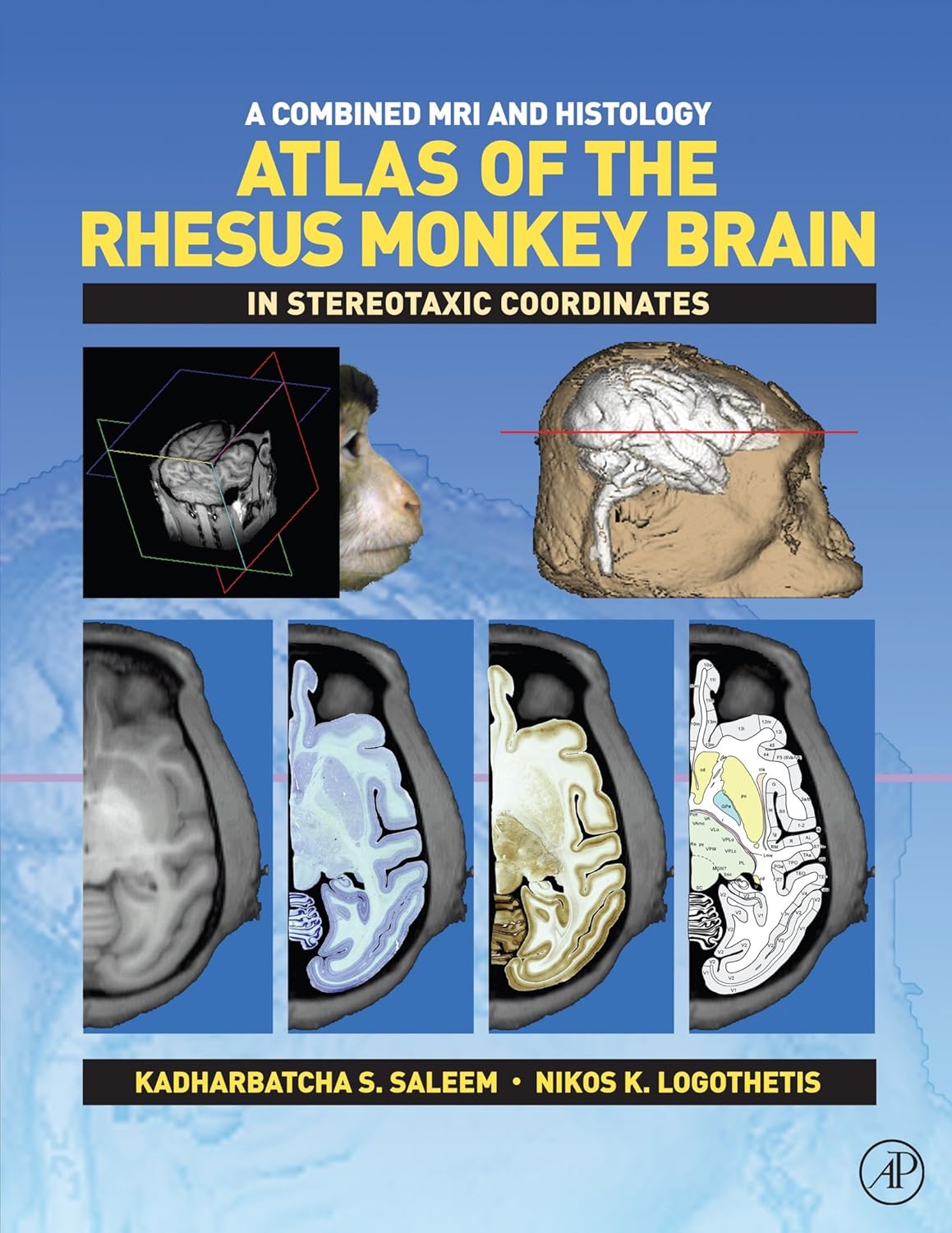 A Combined MRI and Histology Atlas of the Rhesus Monkey Brain: In ...