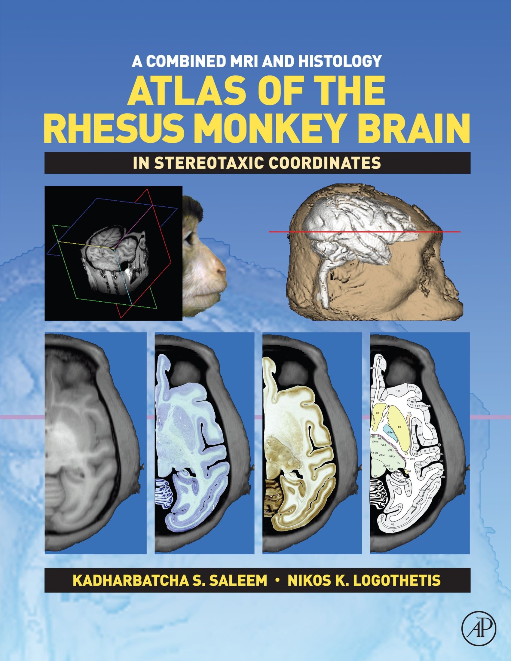 Buy A Combined MRI and Histology Atlas of the Rhesus Monkey Brain: In ...