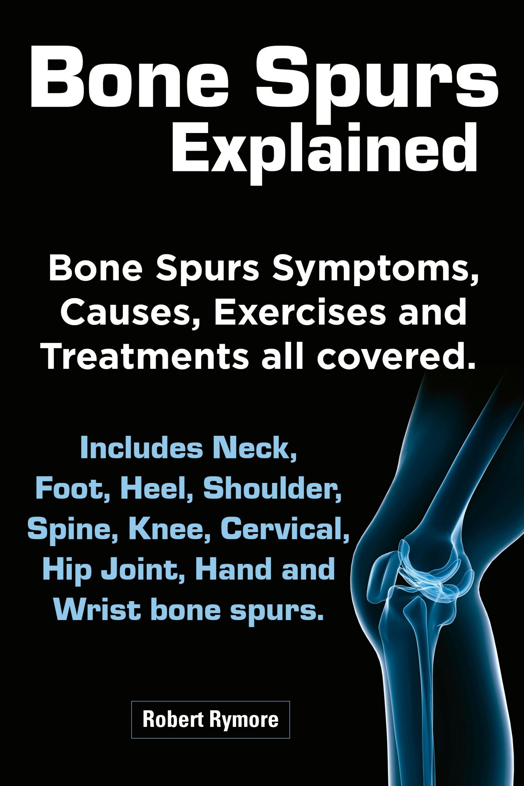 Buy Spurs explained. Spurs Symptoms, Causes, Exercises and s all ...