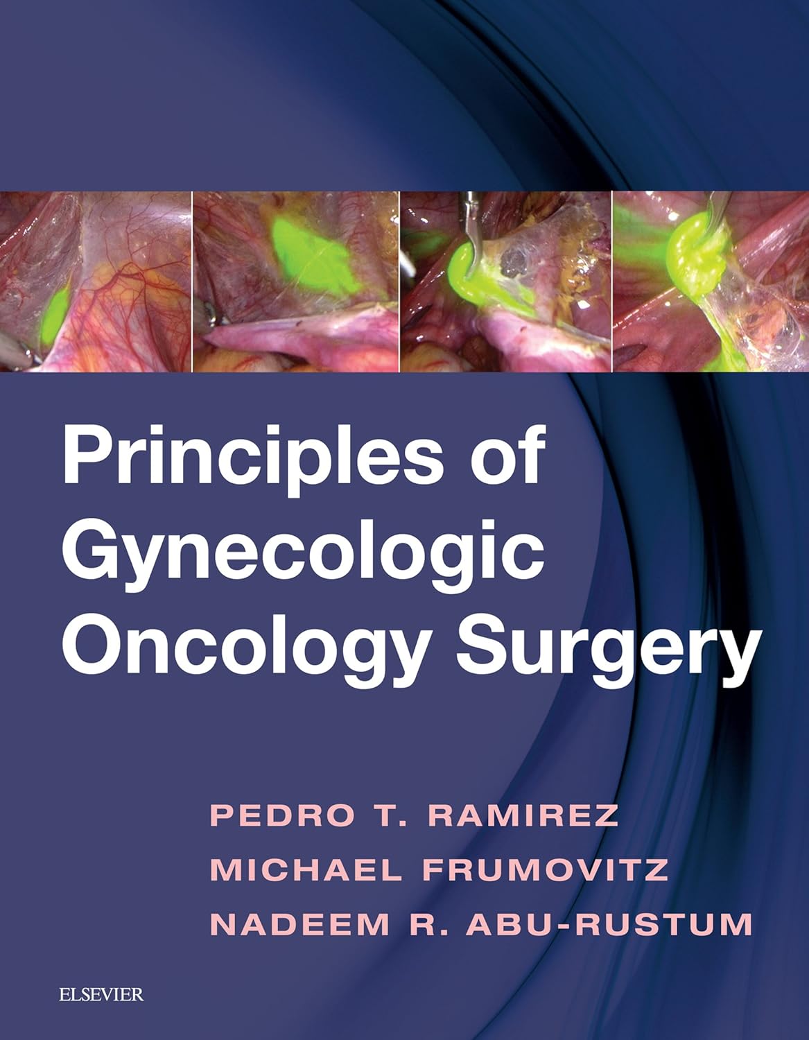Amazon.com: Principles of Gynecologic Oncology Surgery E-Book eBook ...