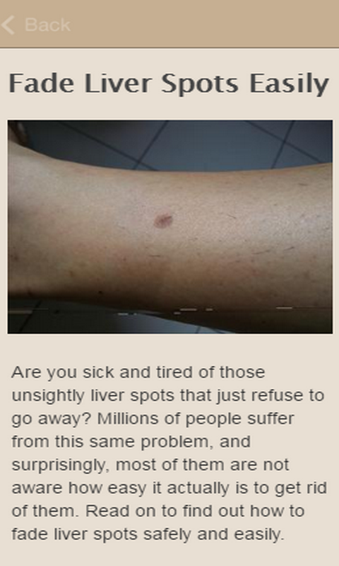How To Remove Liver Spots - App on the Amazon Appstore