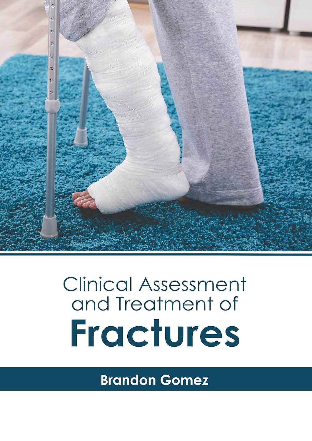 Clinical Assessment and Treatment of Fractures: 9781639279906: Medicine ...