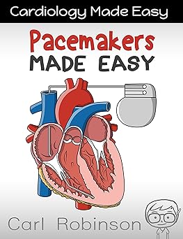 Pacemakers Made Easy: The Pacemaker Manual eBook : Robinson, Carl ...
