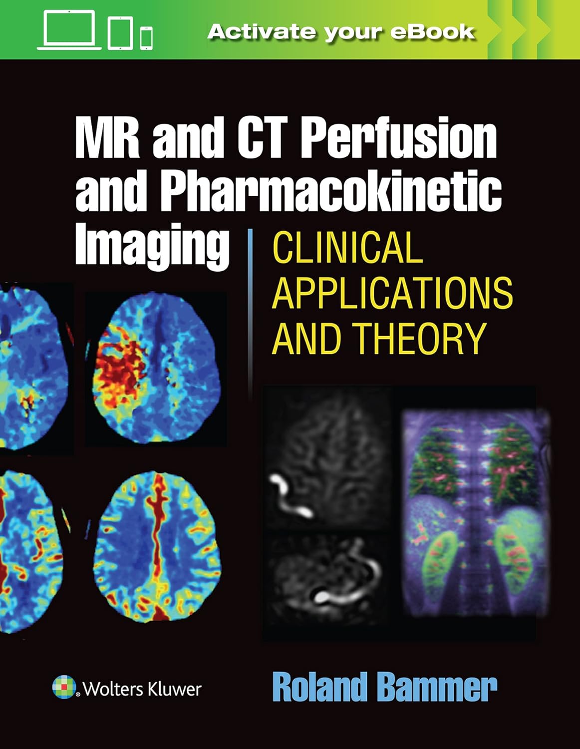 MR and CT Perfusion and Pharmacokinetic Imaging: Clinical Applications ...