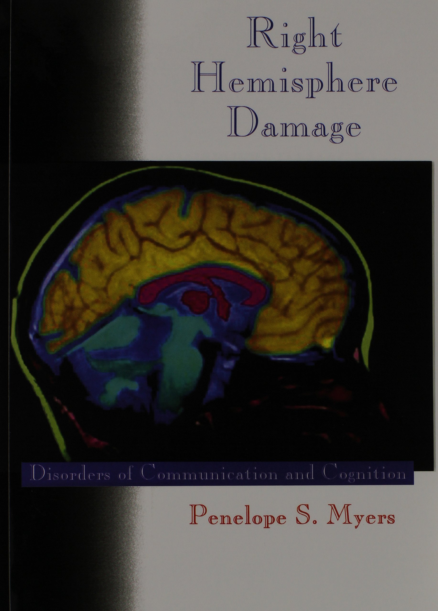 Right Hemisphere Damage: Disorders of Communication and Cognition ...