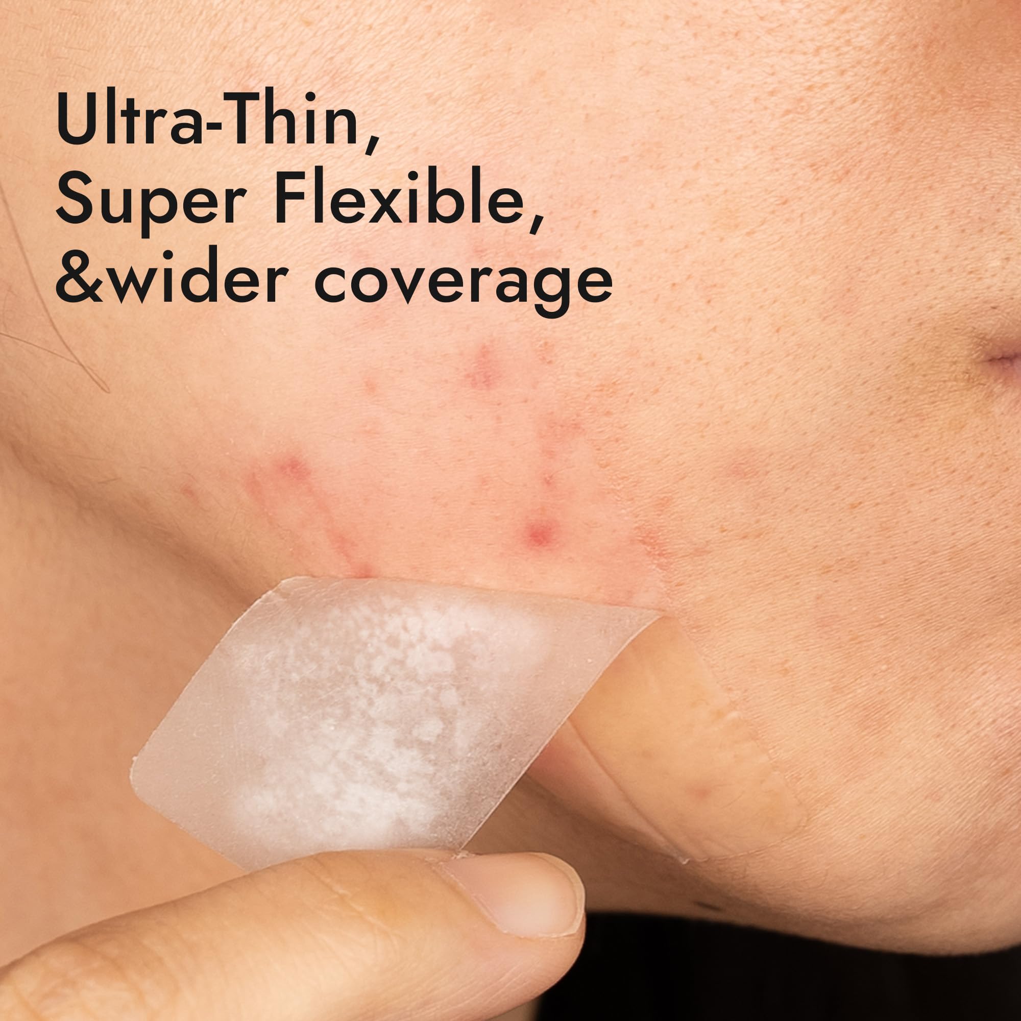 Snapklik.com : Over-Zit XL Acne Clear Patches Ultimate Hydrocolloid ...