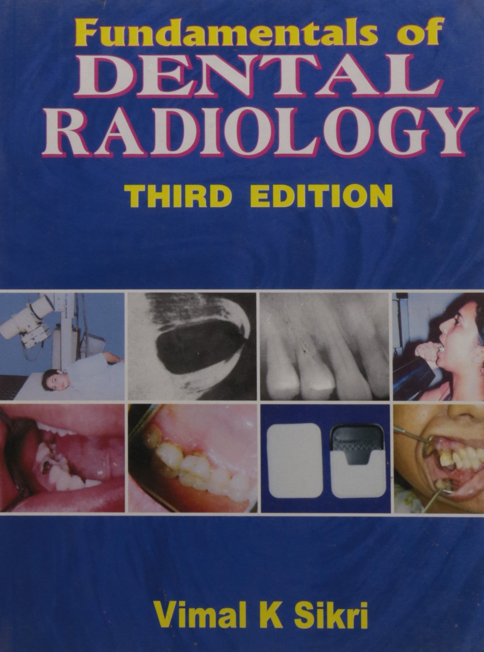 Fundamentals of Dental Radiology: Sikri: 9798123913574: Amazon.com: Books
