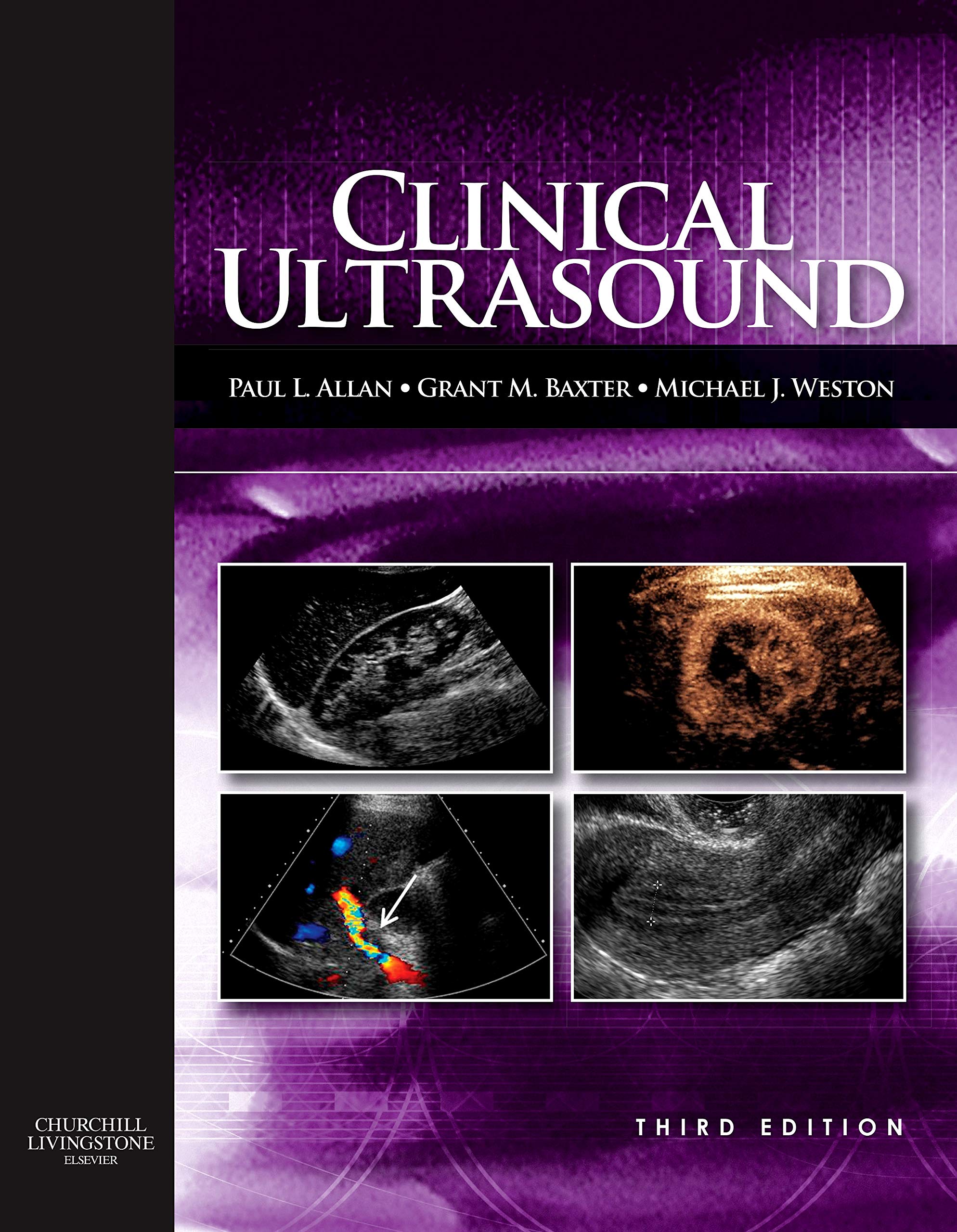 Clinical Ultrasound, 2-Volume Set: Expert Consult: Online and Print ...