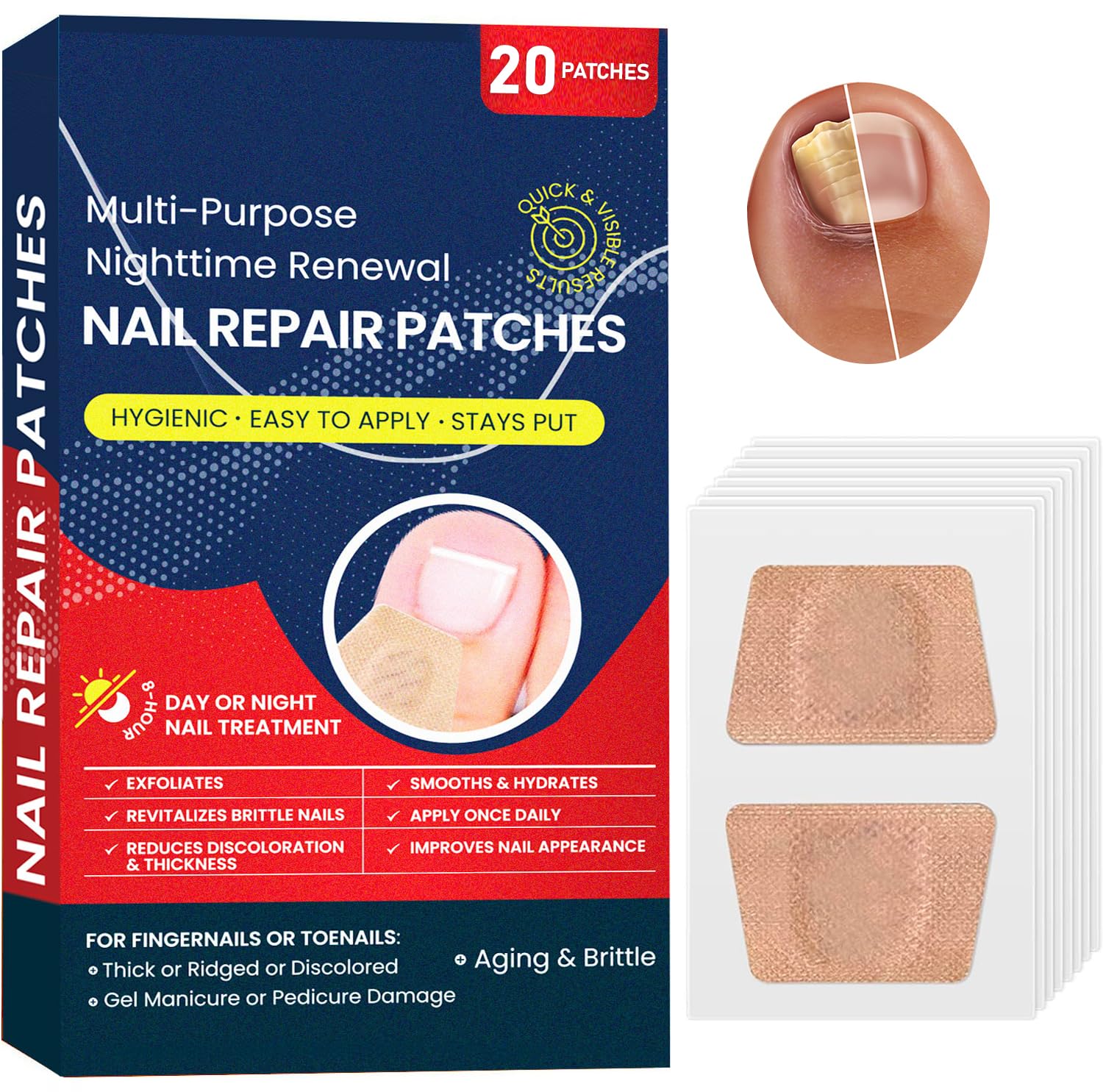 Amazon.com: Toenail Fungus Treatment for Nail Repair: Nail Fungus ...