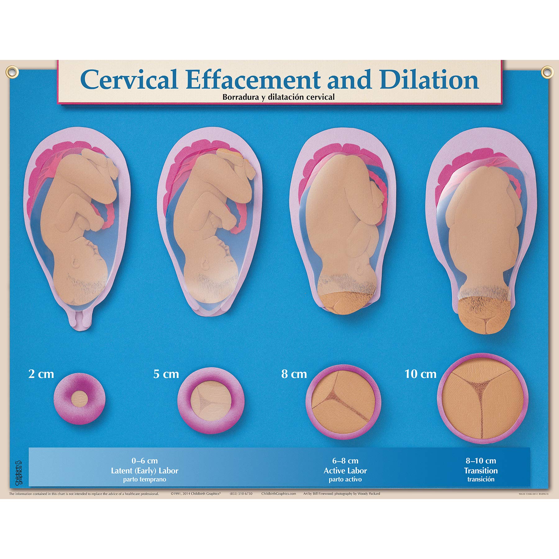 Dilated Cervix Labor