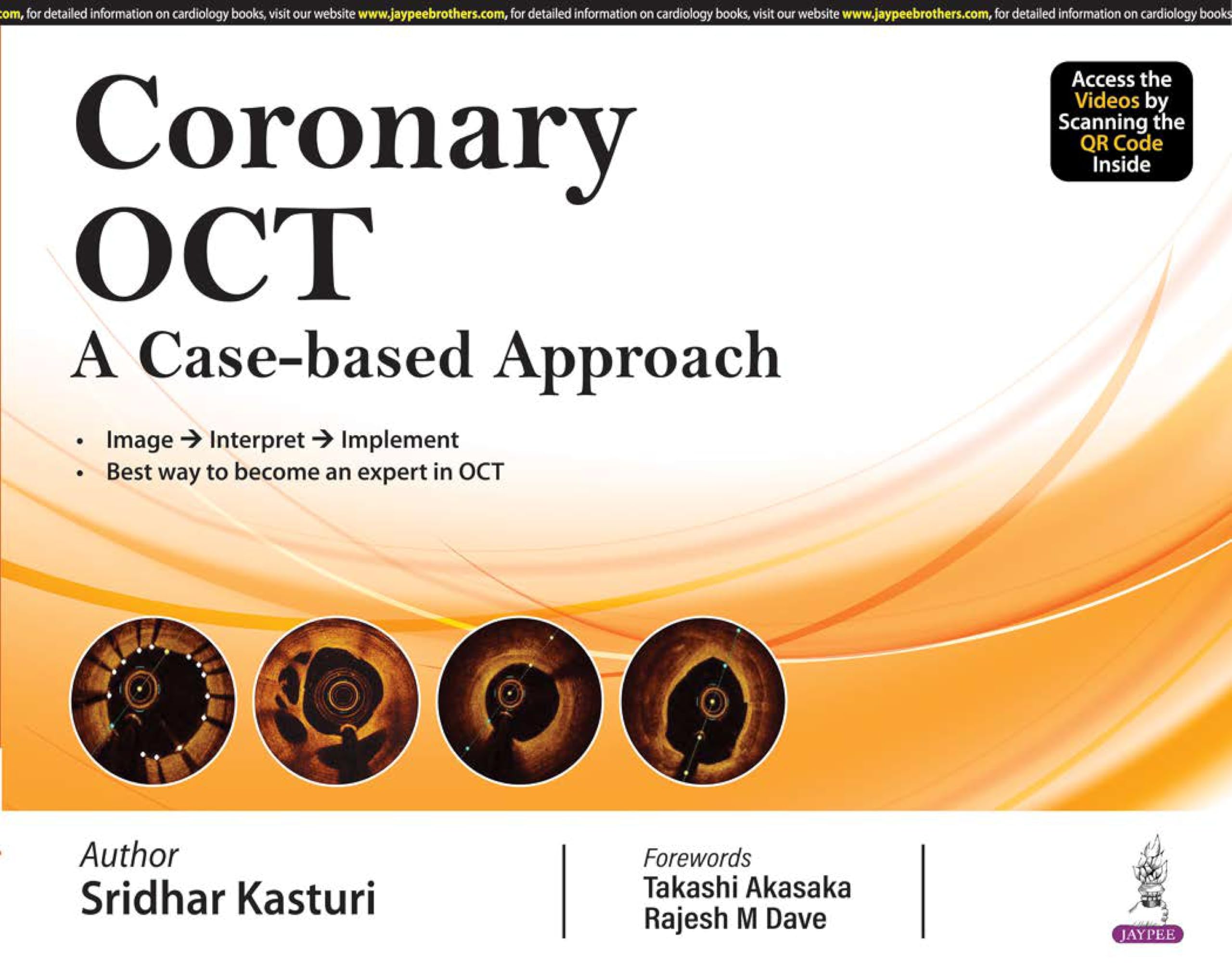 Buy Coronary OCT: A Case Based Approach by SRIDHAR KASTURI Book Online ...