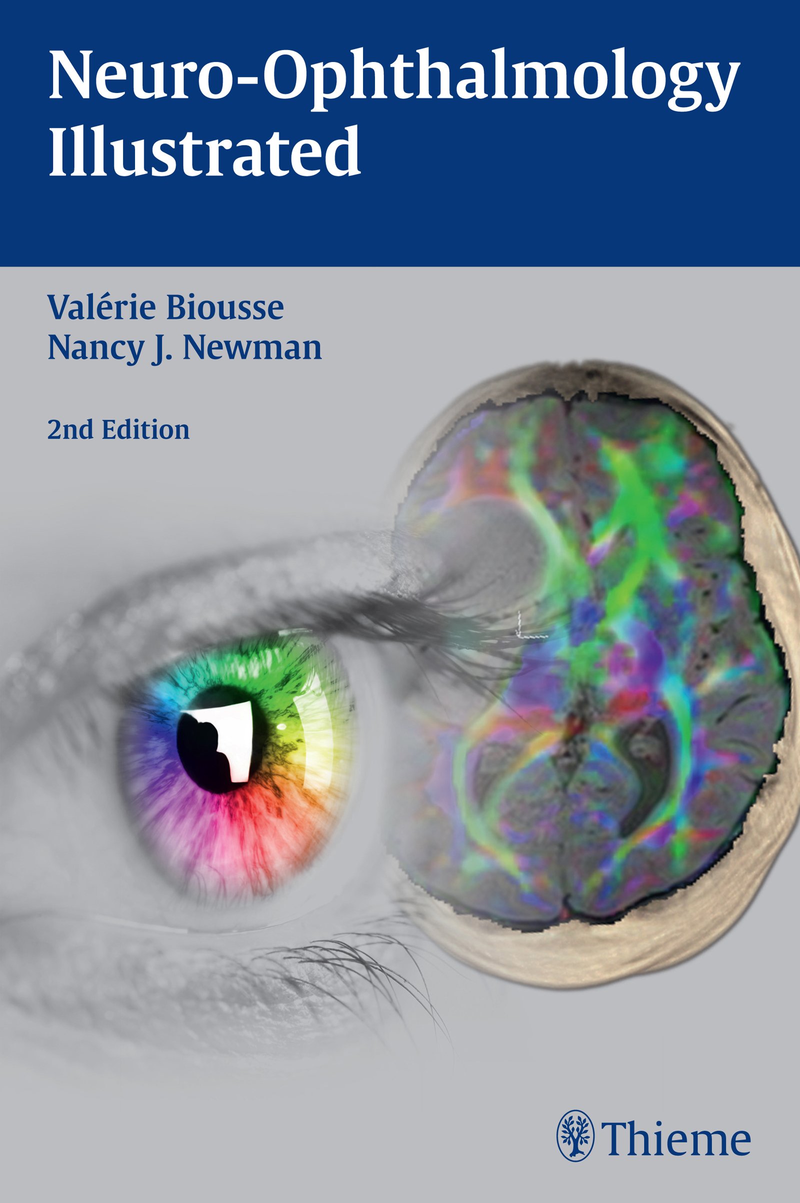 Neuro-Ophthalmology Illustrated: Amazon.co.uk: Biousse, Valerie, Newman ...