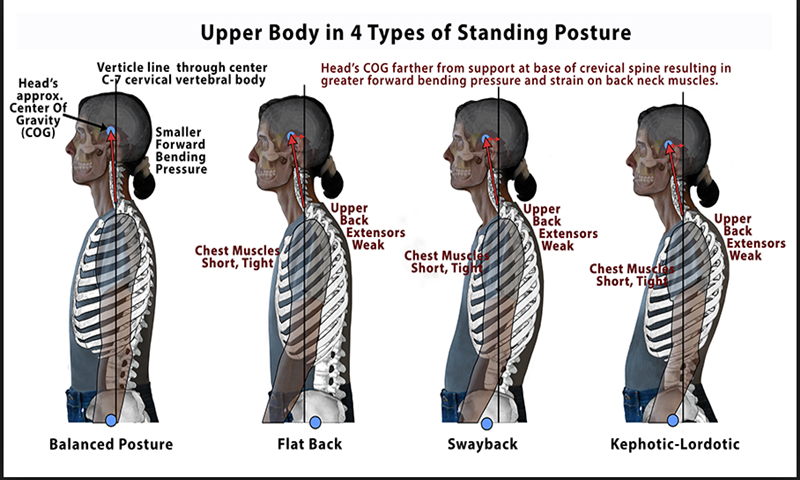 5 Common Posture Problems - App on Amazon Appstore