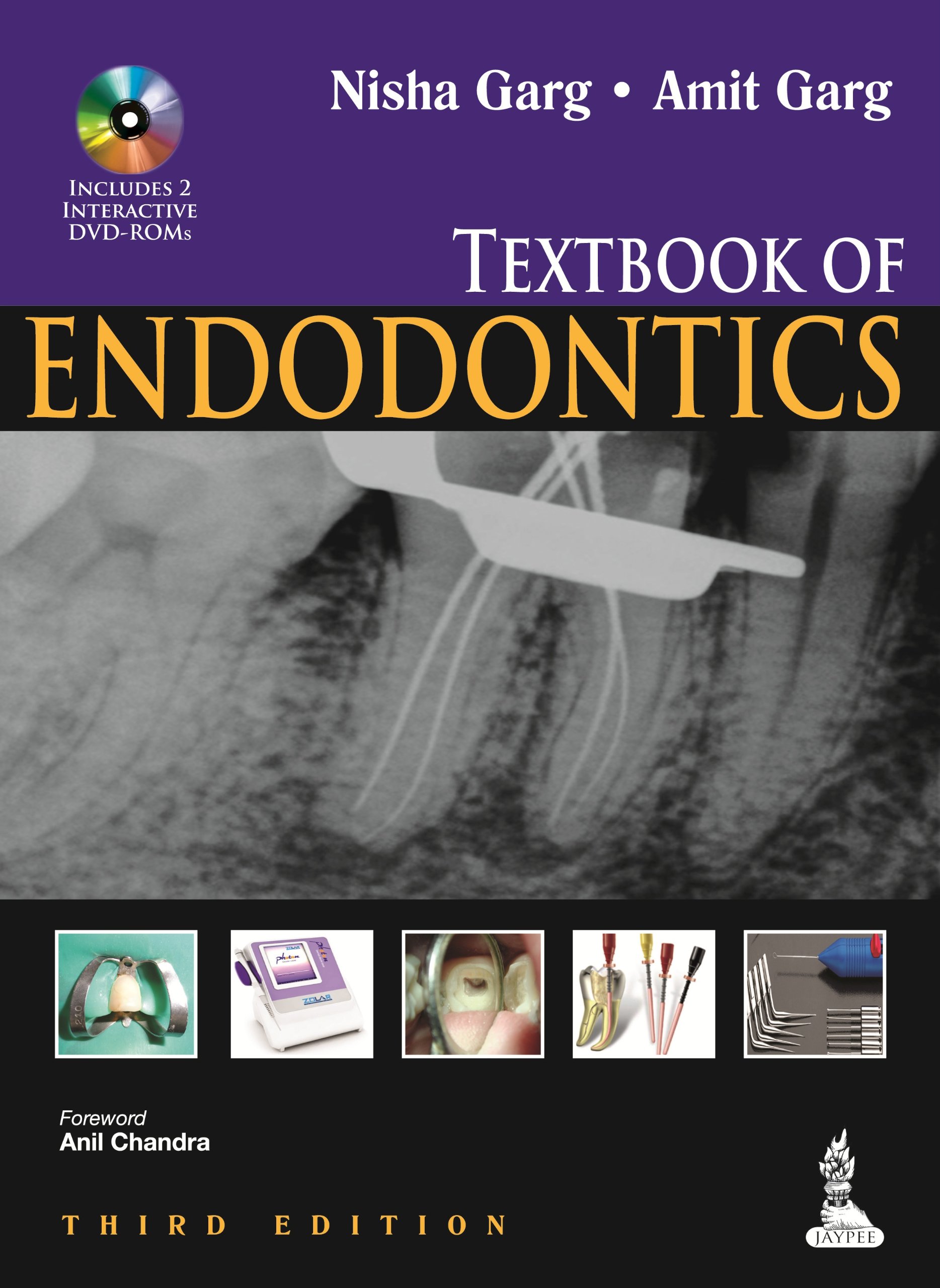Buy Textbook Of Endodontics With 2 Interactive Dvd-Roms (E) 3Ed (Pb ...