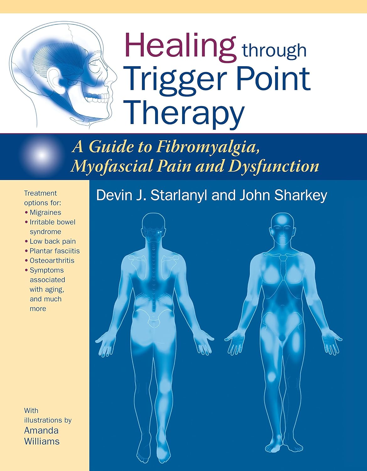 Healing through Trigger Point Therapy: A Guide to Fibromyalgia ...