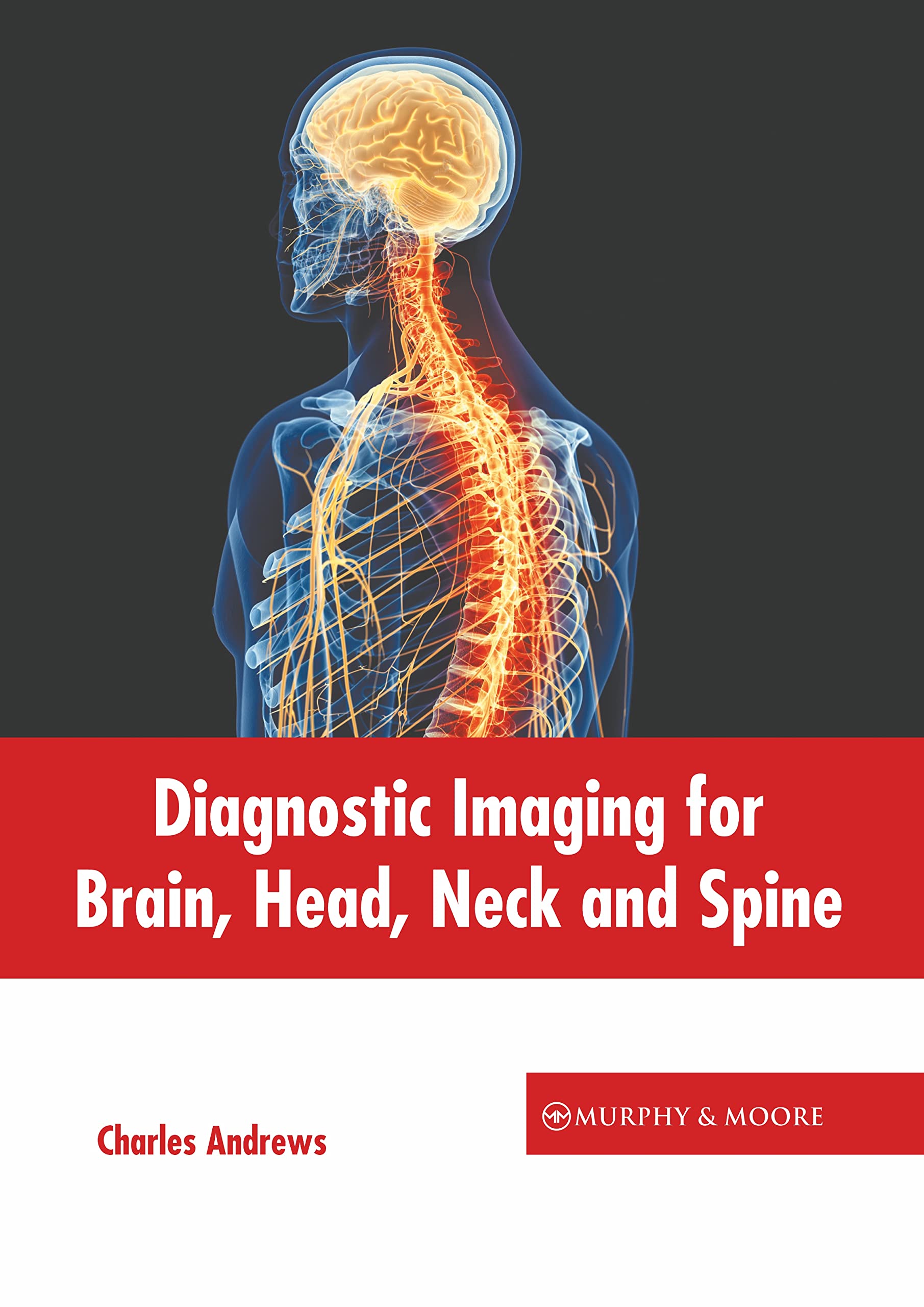 Diagnostic Imaging for Brain, Head, Neck and Spine: 9781639871582 ...