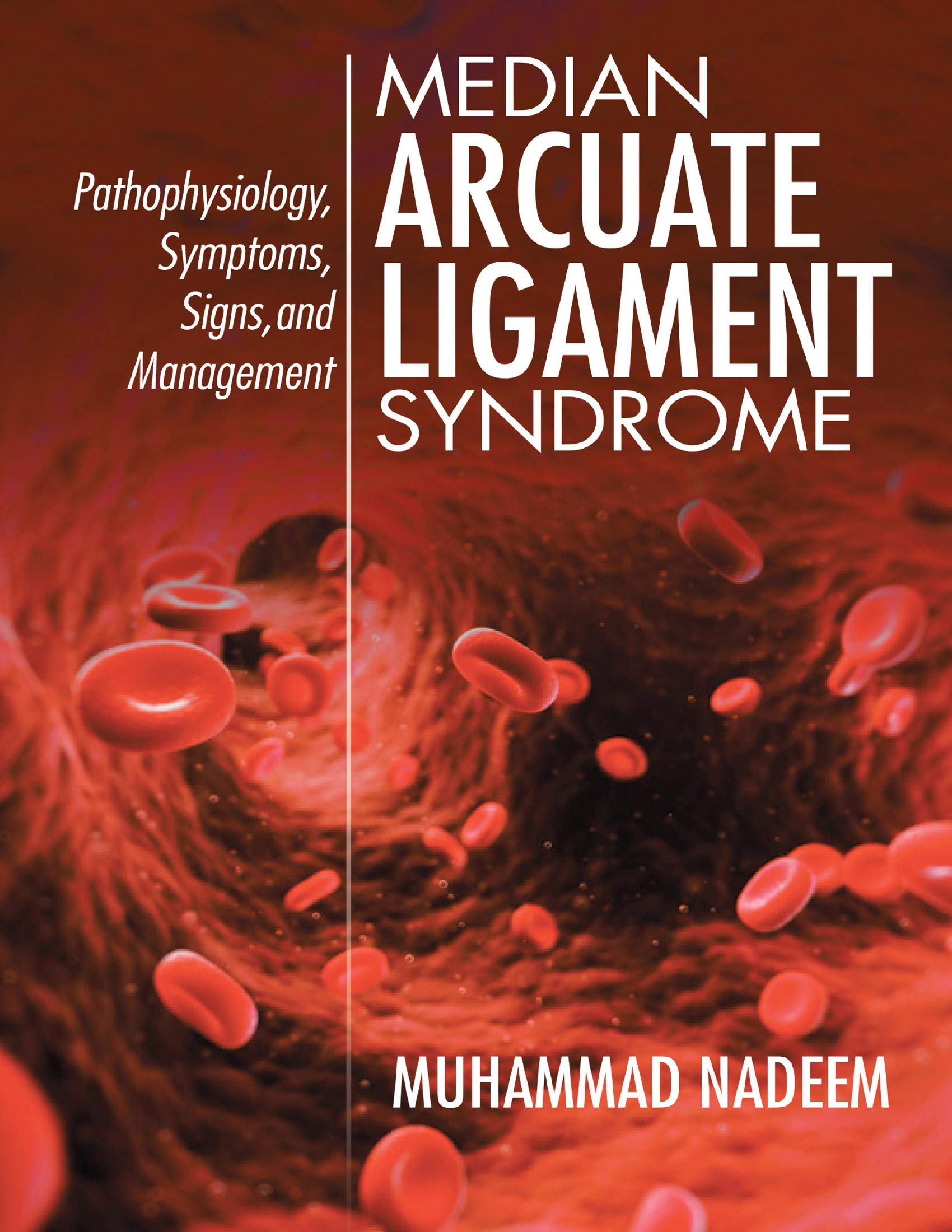 Buy Median Arcuate Ligament Syndrome: Pathophysiology, Symptoms, Signs ...