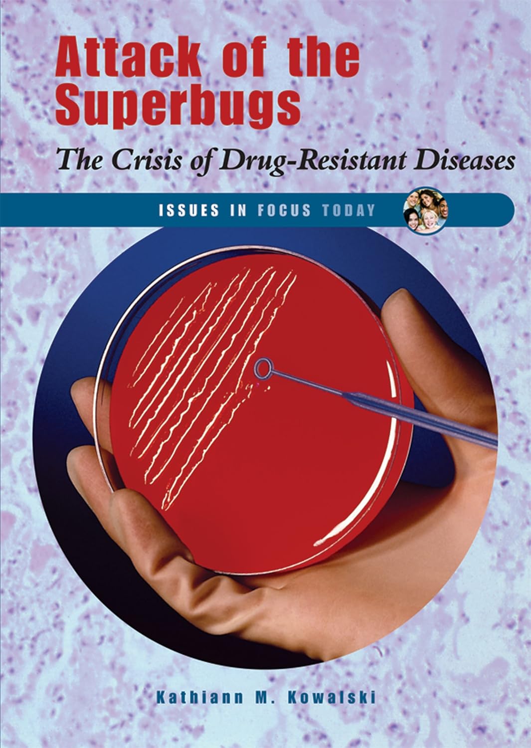 Amazon.com: Attack Of The Superbugs: The Crisis Of Drug-resistant ...