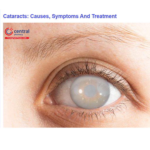 Cataracts: Causes, Symptoms And Treatment - App on Amazon Appstore