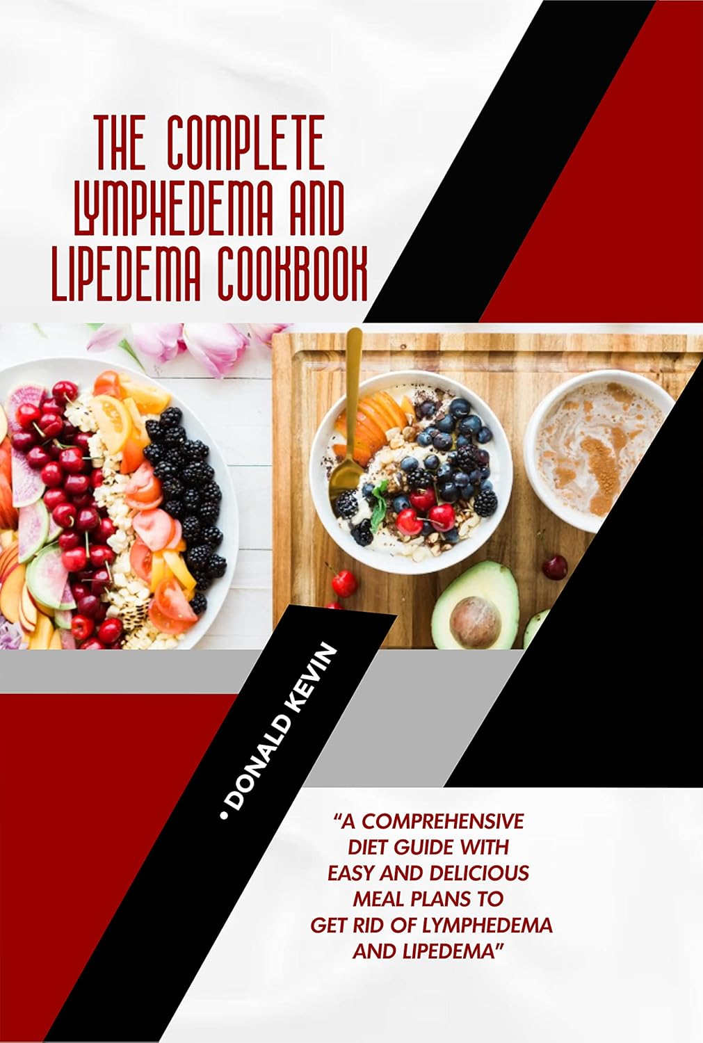 The Complete Lymphedema and Lipedema Cookbook: A Comprehensive Diet ...