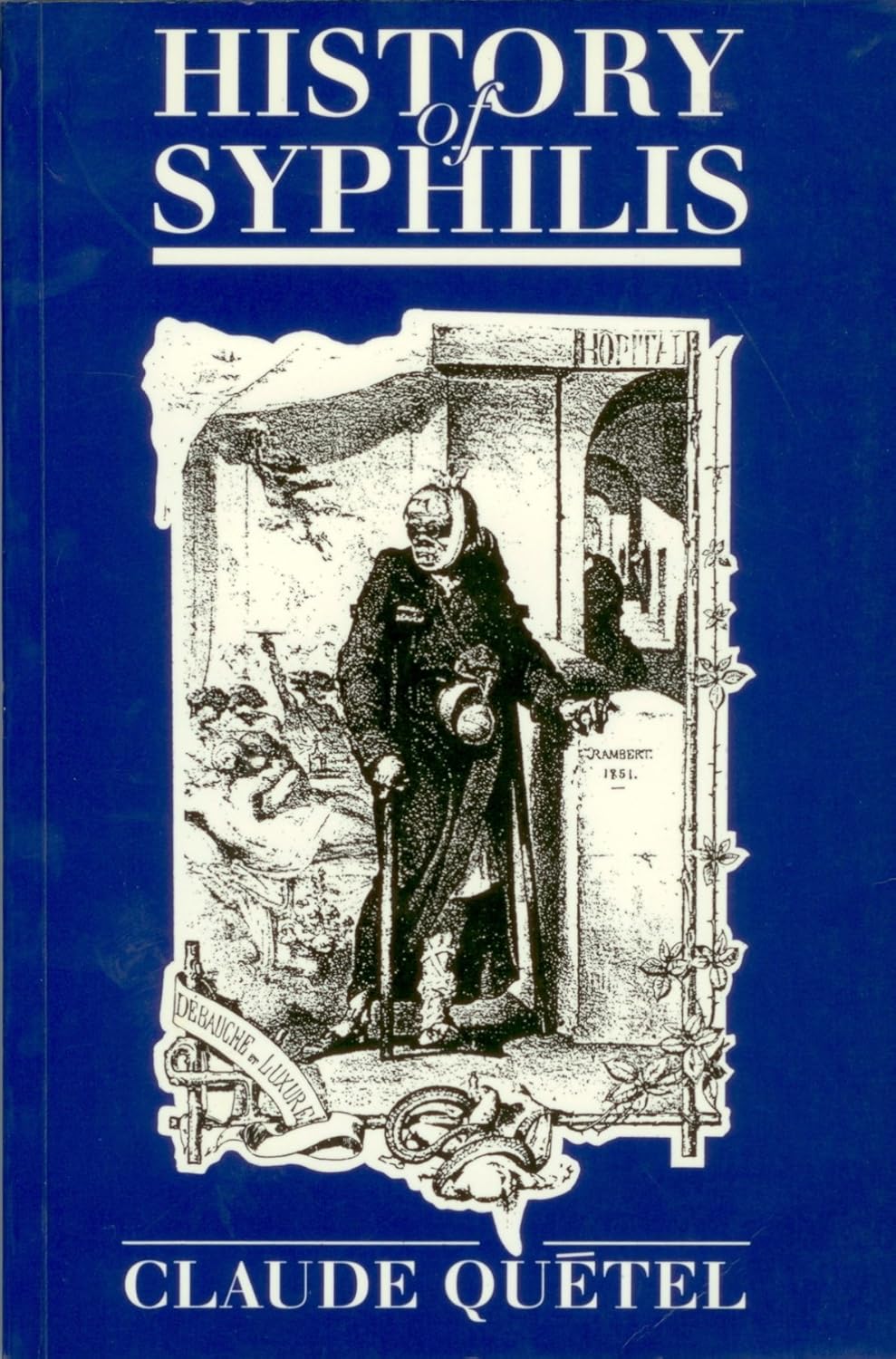 History of Syphilis: Quétel, Claude: 9780745610306: History: Amazon Canada