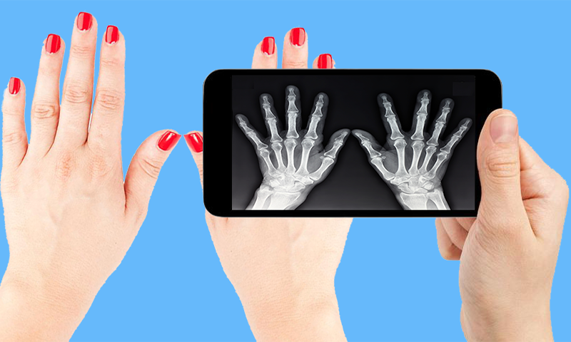 XRay Scanner (Prank) - App on the Amazon Appstore