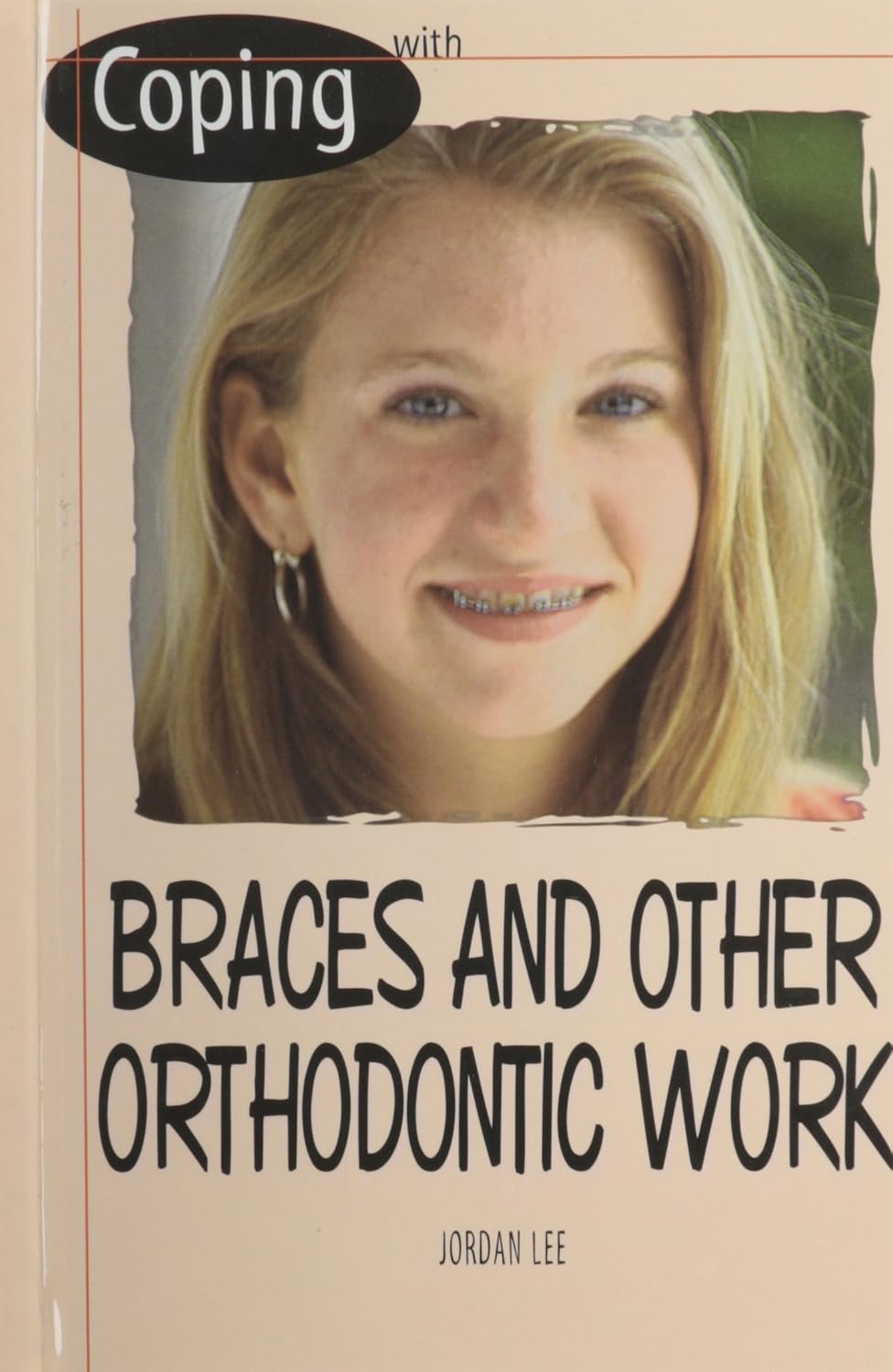 Coping with Braces and Orthodontic Work: Lee, Jordan: 9780823927210 ...