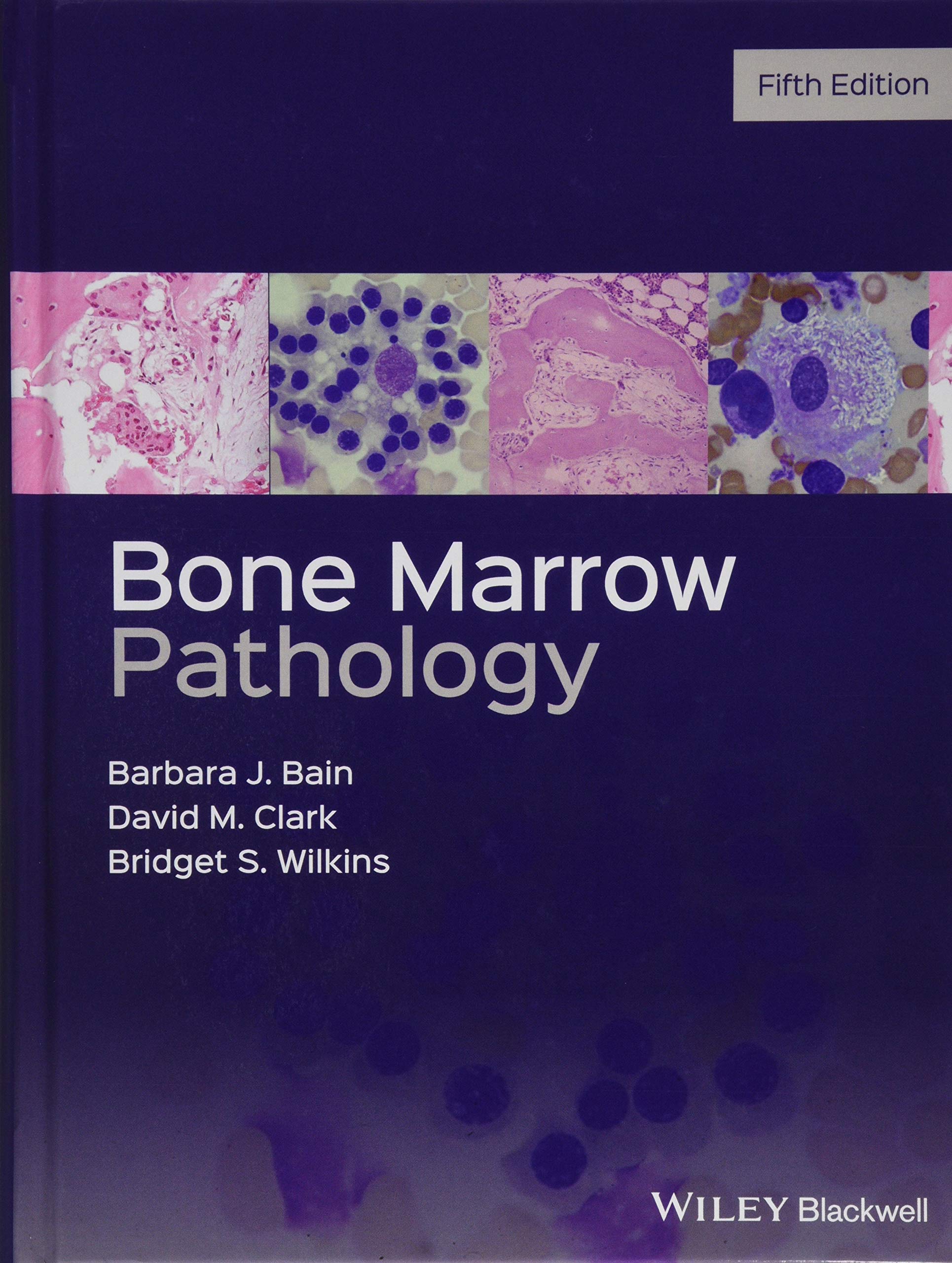 Buy Bone Marrow Pathology Book Online at Low Prices in India | Bone ...