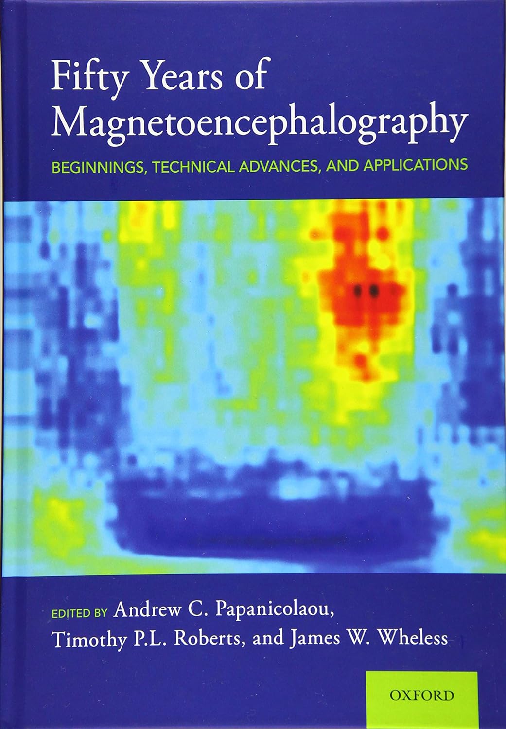 Fifty Years Of Magnetoencephalography Beginnings Technical Advances fifty-years-of-magnetoencephalography-beginnings-technical-advances