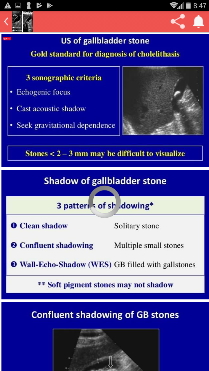 UltraSound Gallbladder - App on Amazon Appstore