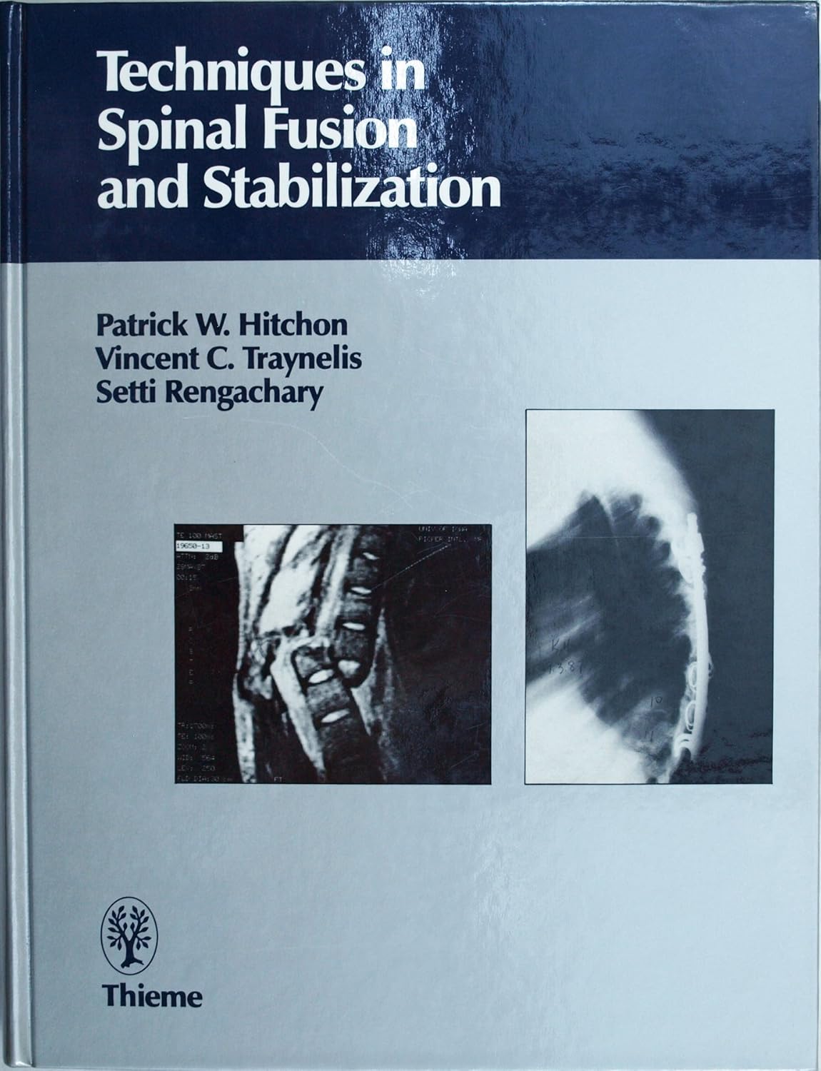 Techniques in Spinal Fusion and Stabilization: Patrick W. Hitchon ...