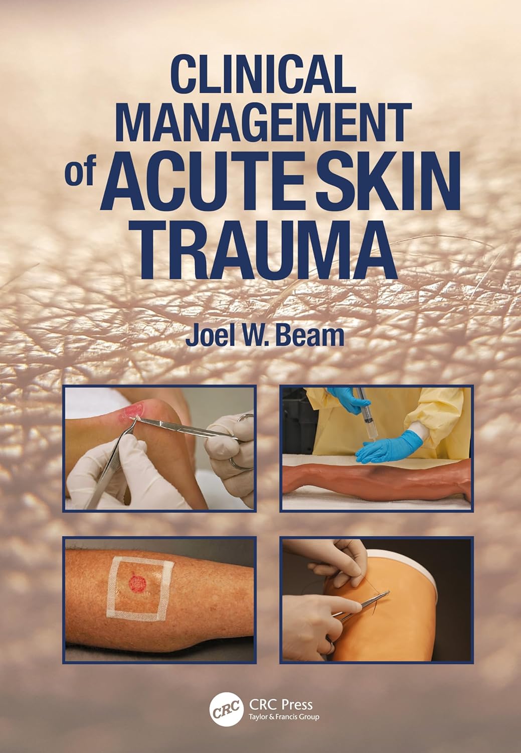 Clinical Management of Acute Skin Trauma: Amazon.co.uk: Beam, Joel W ...