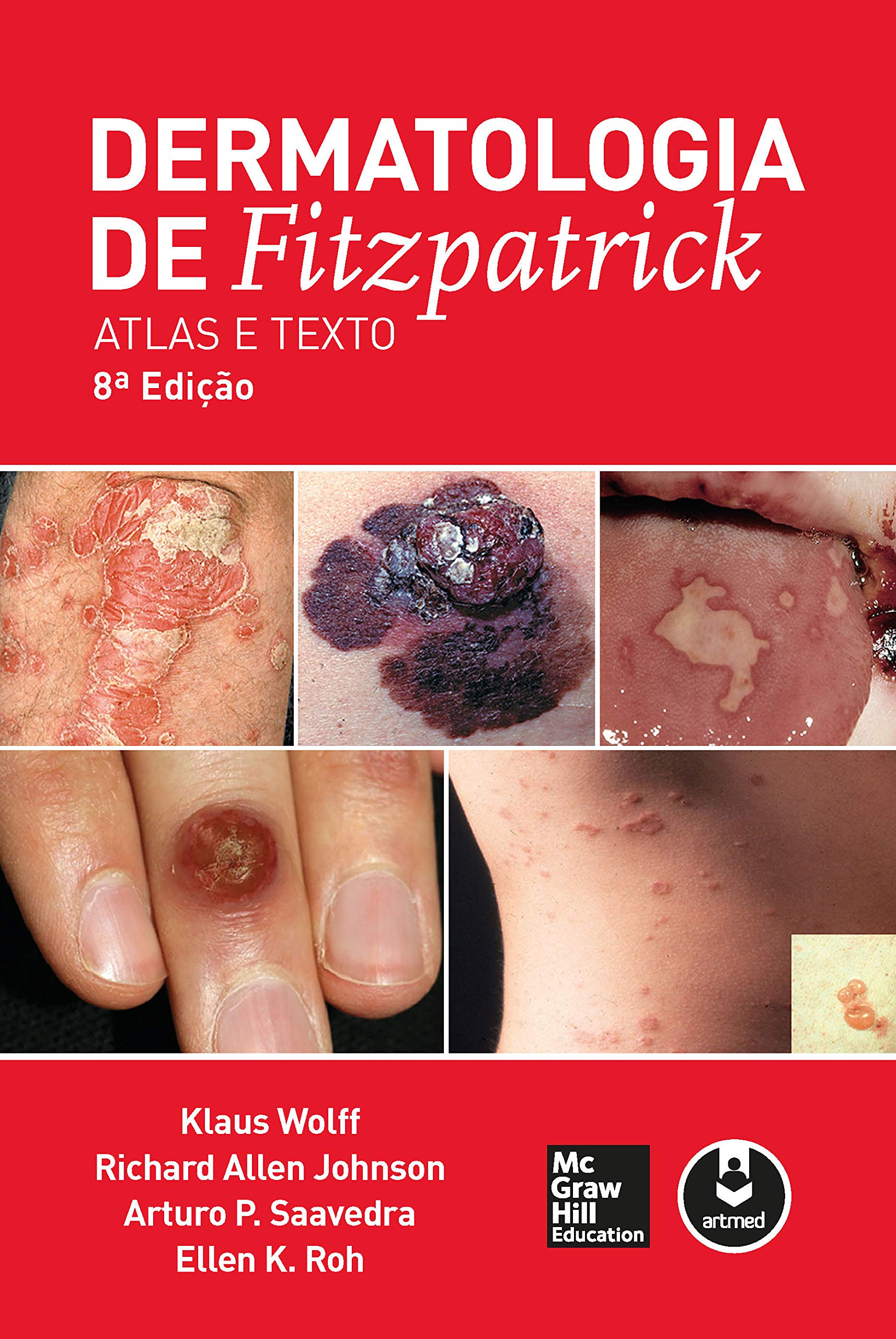 Amazon.com: Dermatologia de Fitzpatrick: Atlas e Texto: 9788580556230 ...