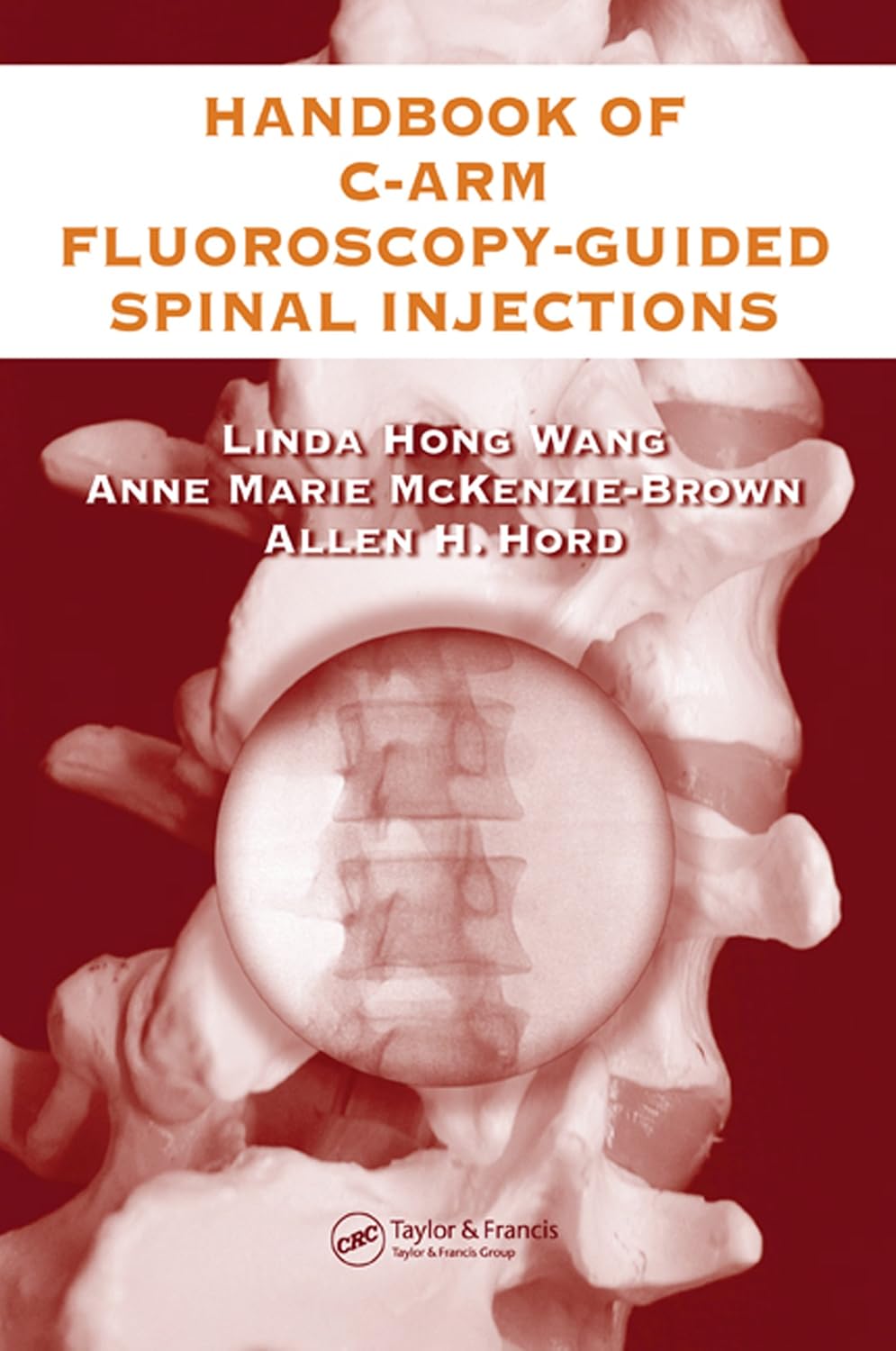 The Handbook of C-Arm Fluoroscopy-Guided Spinal Injections eBook : Wang ...